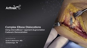 Using InternalBrace™ Ligament Augmentation Procedure for Complex Elbow Dislocations