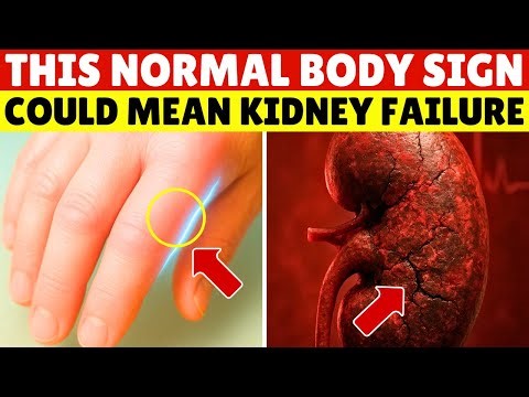 Foamy Urine: Silent Kidney Disease Symptoms You’re Missing (Doctor Reveals Warning Signs)