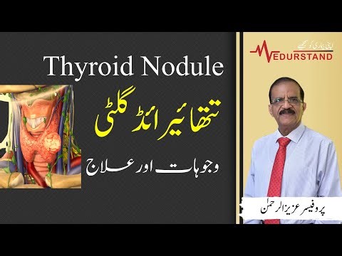 Urdu: تتھائیرائڈ گلٹی Thyroid Nodule | Causes, Diagnosis and Treatment | Medurstand by Prof Aziz