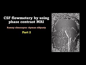 MRI CSF flowmetery part 2👉 physical principle