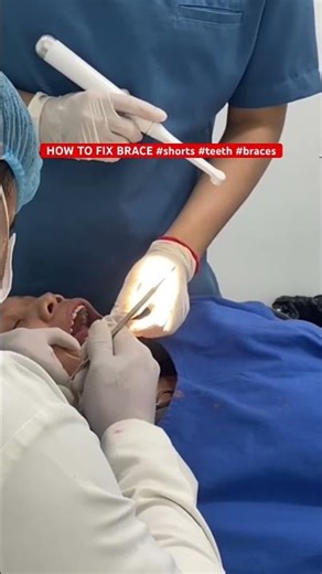 HOW TO FIX BRACE #shorts #teeth #braces