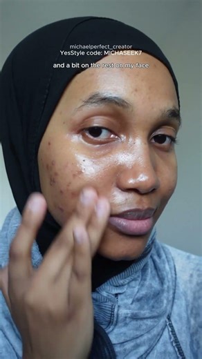 Axis-Y Dark spot correcting glow serum routine to cure acne #koreanskincare #skincare #glassskin