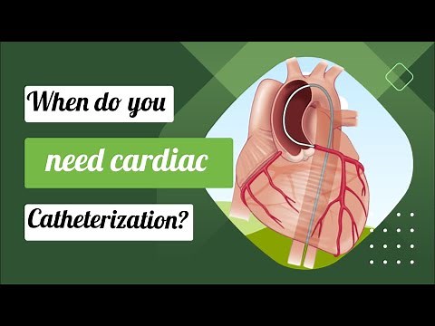 Everything You Need To Know About Cardiac Catheterization!