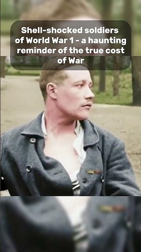 Shell-Shocked Soldier's Of World War 1