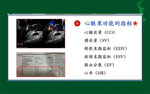#心脏泵功能的评定#人体生理学#医学科普#每天学习一点点_哔哩哔哩_bilibili