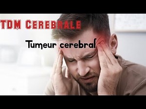 SCANNER CEREBRAL ( Processus expansif intracrânien frontal )