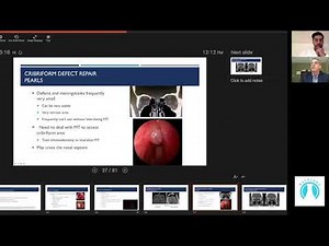 Cerebro Spinal Fluid Leak: diagnosis and surgical treatment