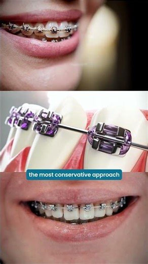 Align First. Perfect Later 💙