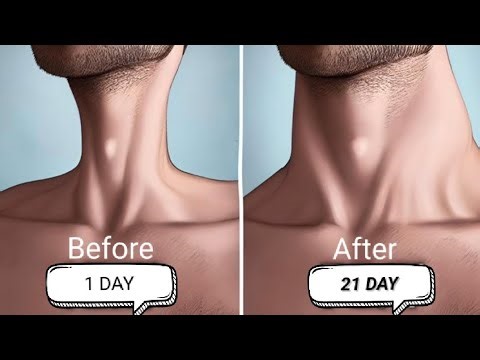 “6 Best Neck Exercises at Home | Reduce Neck Fat & Pain | RKGym Fitness”