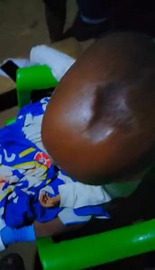 85K views · 1.4K reactions | Wow little Konowa surgery was successful. We thank God for him. All thanks to sis B-Lyte Zagabe for his medical bill and thanks also to Benita Whitney Urey for the recommendation and also standing in the process. God bless u two . I will be going live with he and his mother tomorrow | Still Mie | Facebook