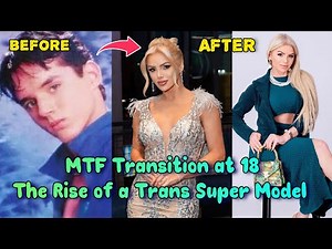 She Transitioned at The Age of 18 and Became a Super Model | Male to Female Transition | MTF