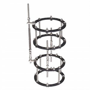 [Hot Item] Elbow Joint External Fixator Tibial Femur Annular Ring Fixator