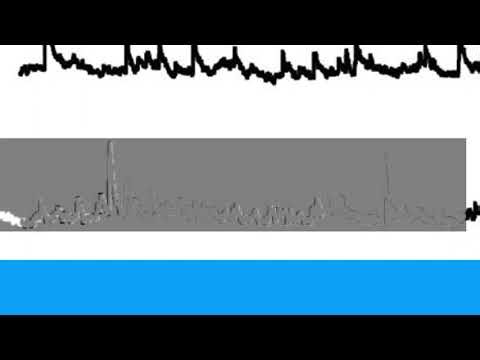 3F5693943E50F6BE1EAB8A078F2428#1