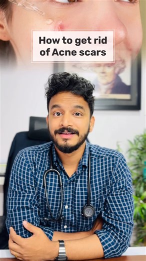 Sujit Telagamsetty | “Say Bye to Acne Scars with These Superfoods & Vitamin C Hacks” • Acne scars treatment • Vitamin C benefits for skin • Superfoods for... | Instagram