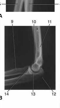 Radiographs of Elbow joint, X-Ray #anatomy#medicalanatomy#learnanatomy#humananatomy#anatomystudy