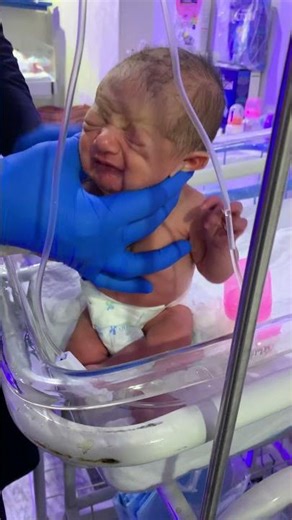 Baby Burping After Feeding 🍼 | Newborn Care Shorts #newborn #cute