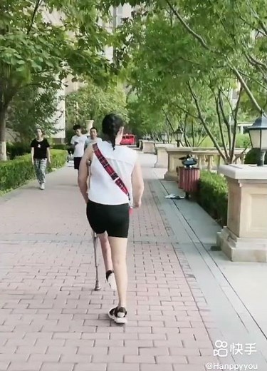 Polio shortleg woman.