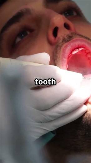 Tooth Decay Fix or Replace 🦷