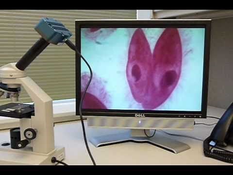 Close-up Look: Digital Microscope Cameras