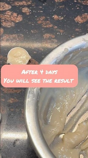 Get Rid of Cockroaches Instantly | Hack to Kill Cockroaches in House | Easy Home Remedy