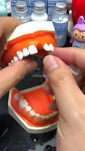 Temporary tooth kit 🤩 #shorts