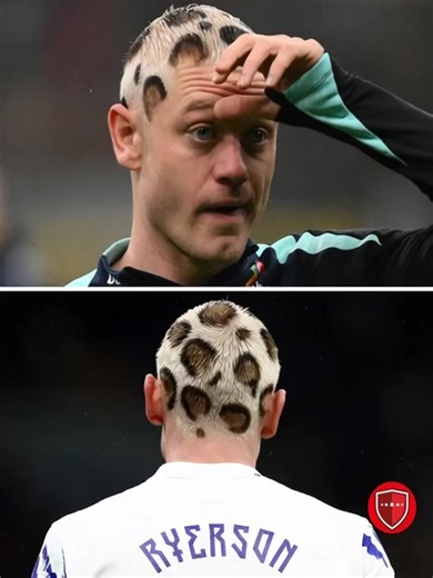 Norway's Julian Ryerson with comfortably the worst trim we've ever seen against Italy tonight 😂 He's out here looking like the 101 Dalmatians #ryerson #norway | Fotball world