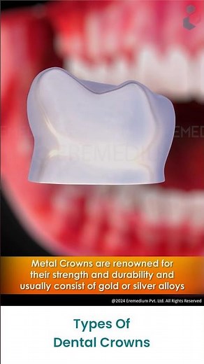 Know about Types Of Dental Crowns ↪ 3D Medical Animations #DentalCrowns #Dental #Shorts