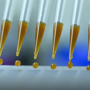 Sorbitol dehydrogenase deficiency is a genetic condition that causes a recently identified peripheral neuropathy. In this test-specific episode of the "Answers From the Lab" podcast, Matthew Schultz, Ph.D., and Amy White, M.S., CGC, explain how Mayo Clinic Laboratories' unique urine assay screens for this common peripheral neuropathy. https://bit.ly/4f2XtQ6 | Mayo Clinic Laboratories