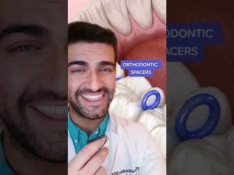 How to Eat With Separators in Your Mouth