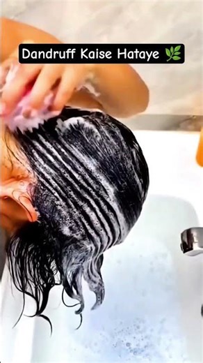 Best Anti DANDRUFF Shampoo #shorts #dandruff #haircare #hairmasks #hairloss #ghaffarbhai #birdtrend