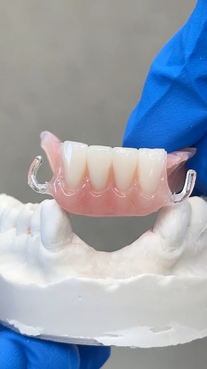 3.4K views · 55 reactions | Flipper Partial with Clear Clasps! Case from Dr. Young Kim in Illinois! Lincolnway Dental Center | Luke Kahng | Facebook