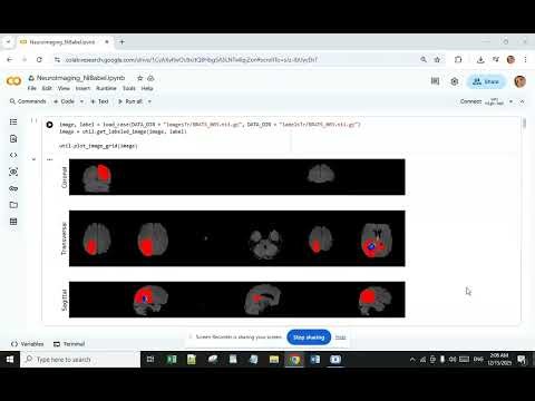 NeuroImaging_NiBabel