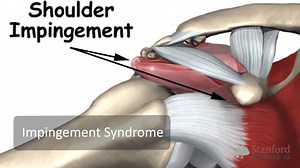 1.4K views · 24 reactions | The Exam for Shoulder Pain - Stanford Medicine 25 | Hippocrate's Students | Facebook