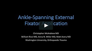 OTA Video Library - Ankle-Spanning Externa Fixator Application - McAndrew