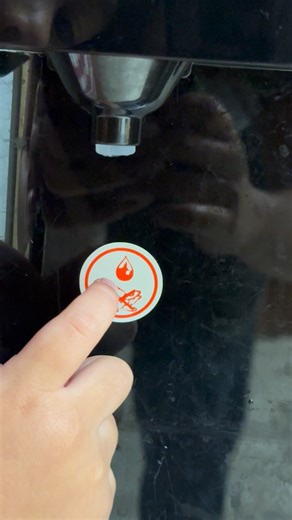 “nooooo frog in the water” mesen lihe anahne cataract surgery 🤣🤣🤣🤣 #ringangs #reelsvideoシ #yaseneinotsoiasenei #fbreels2025ツ | Cheryll Oliver Ligohr