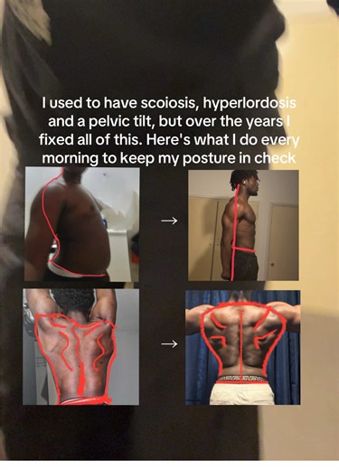 Improve Your Posture and Restore Height Easily