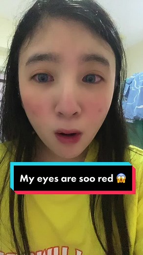 Kontrobersyal na Kwento ng Mga Contact Lens 😱