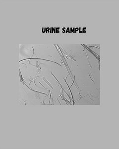 84K views · 1.2K reactions | Urine sample ❤️ How many do you get correctly? | Lab life | Facebook