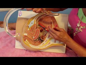 Trigger-Wand : In-Depth rectal release for pelvic pain in men and women. "The Pelvic Whisperer"