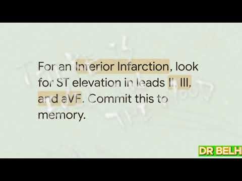 Acute Coronary Syndrome: The "Highway" Secret Nobody Taught You