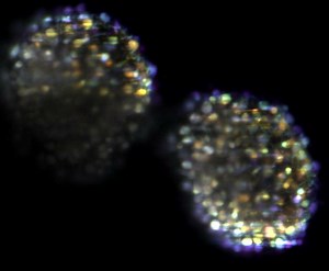 File:Imaging-of-human-differentiated-3D-neural-aggregates-using-light-sheet-fluorescence-microscopy-Movie3.ogv - Wikimedia Commons