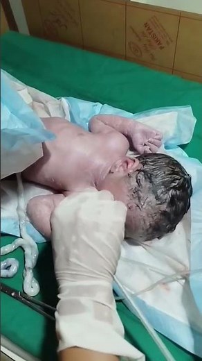 SUCTIONING (CORRECT TECHNIQUE) IN NICU _ NICUNEWBORNCARE