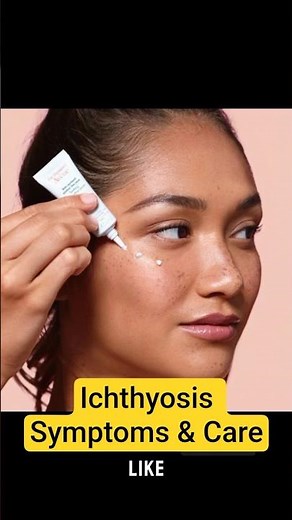 Rare Skin Disorder That Turns Skin into Scales | Ichthyosis Symptoms & Care