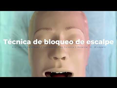 Tecnica de Bloqueo de Scalp - Dra. Ahida Velázquez Castillo