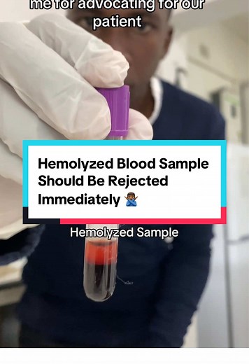 Understanding Hemolyzed Blood Samples in Lab Testing