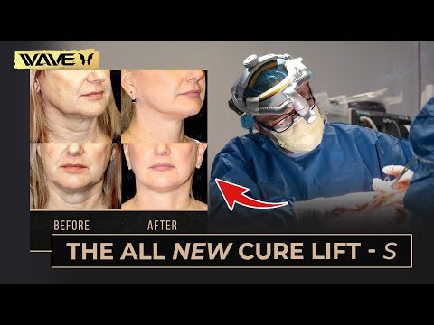 The New and Improved Cure Lift - S | Wave Plastic Surgery