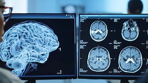 Download Doctor Analyzing Brain MRI Scan for free