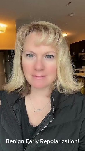 1.4K views · 12 reactions | Benign early repolarization!  Follow NTN for guidance, support & mentoring! 喙 Credit: Cardiology MADE EASY #Nurses #NursingStudent #NursingSchool #ICUNurse #HealthcareWorkers #NurseLife #CRNASchool | TeachRN | Facebook