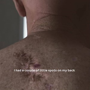 As the Aussie summer heats up, get smarter about skin protection with TAL SpotChecker. Good health begins with your skin so head to TAL SpotChecker to find out how you can get a skin check this summer. | TAL