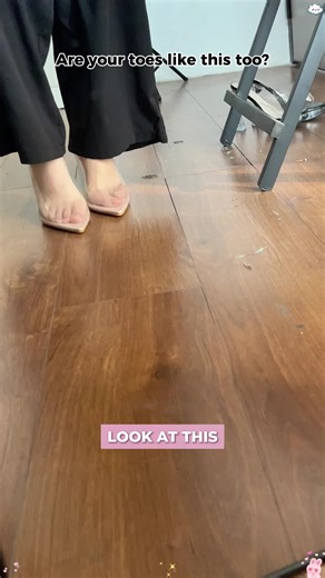 #bunion #corrector #foot #health #tiktokshop | bunion corrector